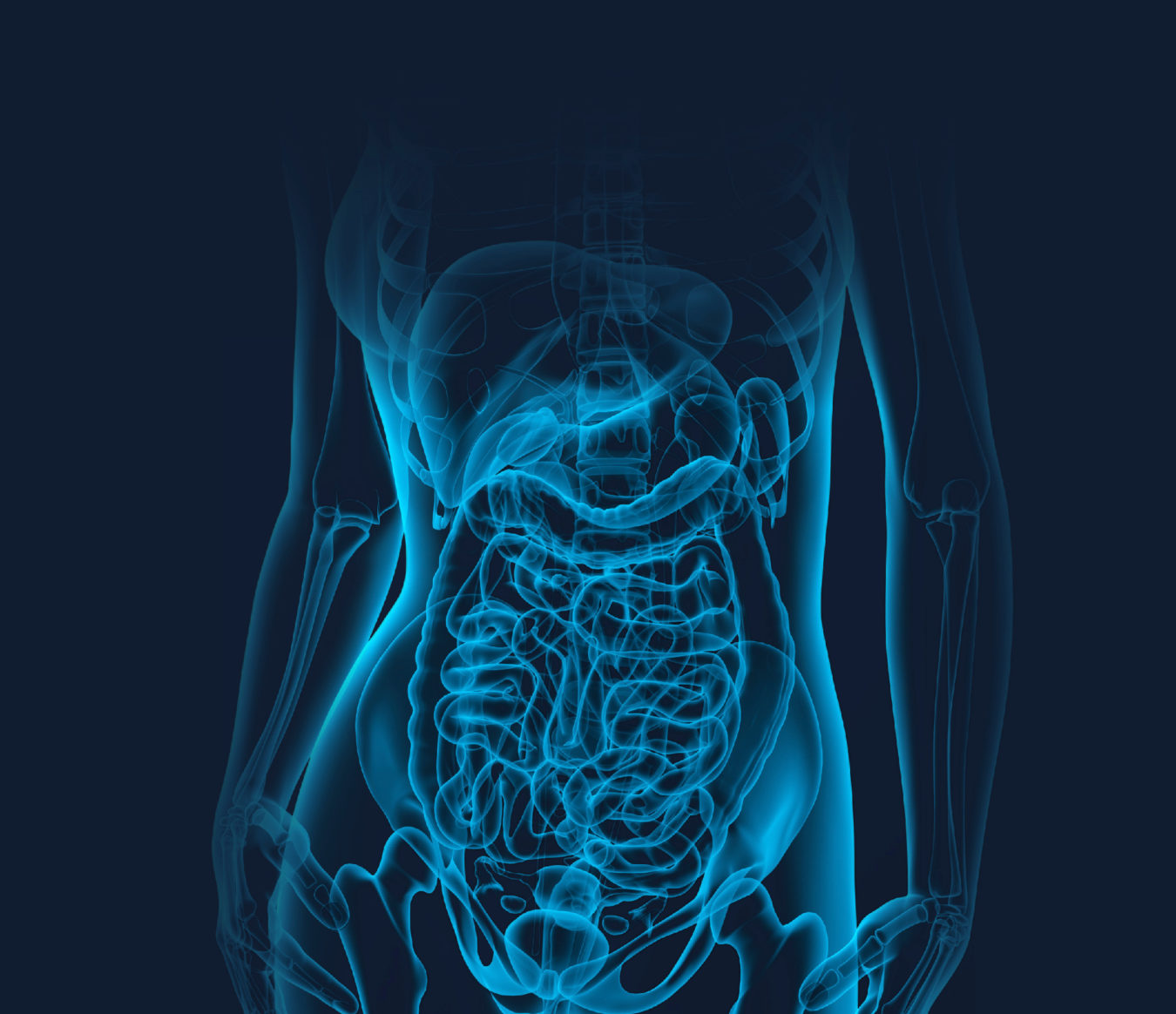 Nautilus — Dornier MedTech Americas