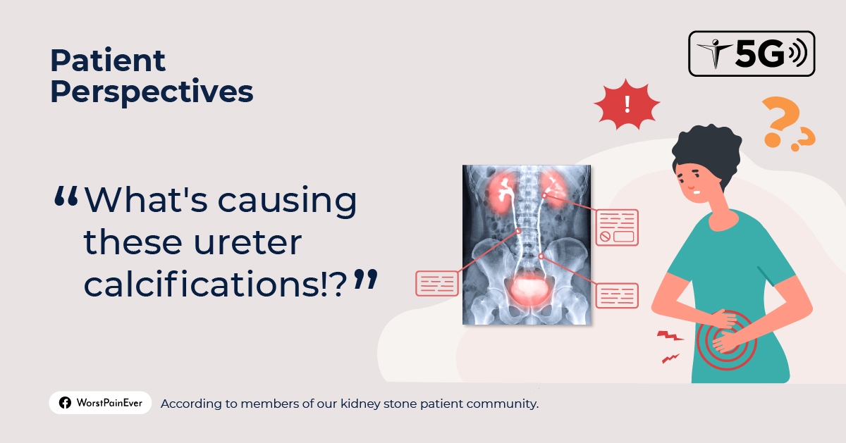 More Patients are Experiencing Extreme Pain from Ureteral ...