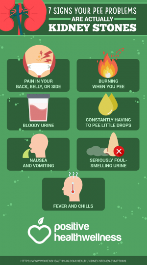 Kidney Stones Patient Center – Dornier MedTech